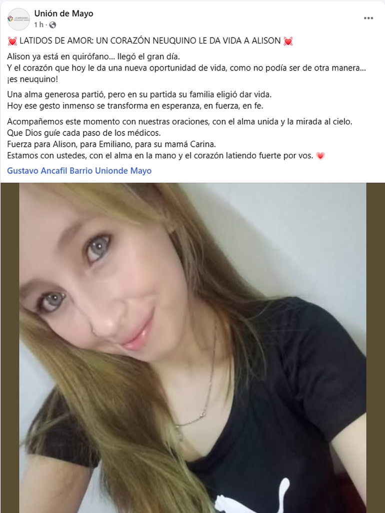 ¡La operación fue un éxito! Alison Calfunao ya tiene corazón y es ...