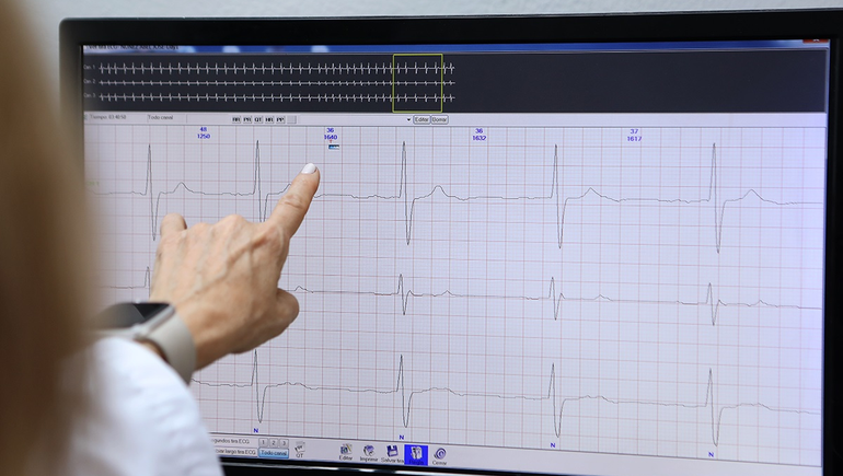 Avance argentino para mejorar los marcapasos