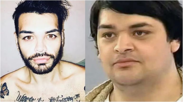 Fotos: el antes y después de Fran Mariano al operarse con Lotocki