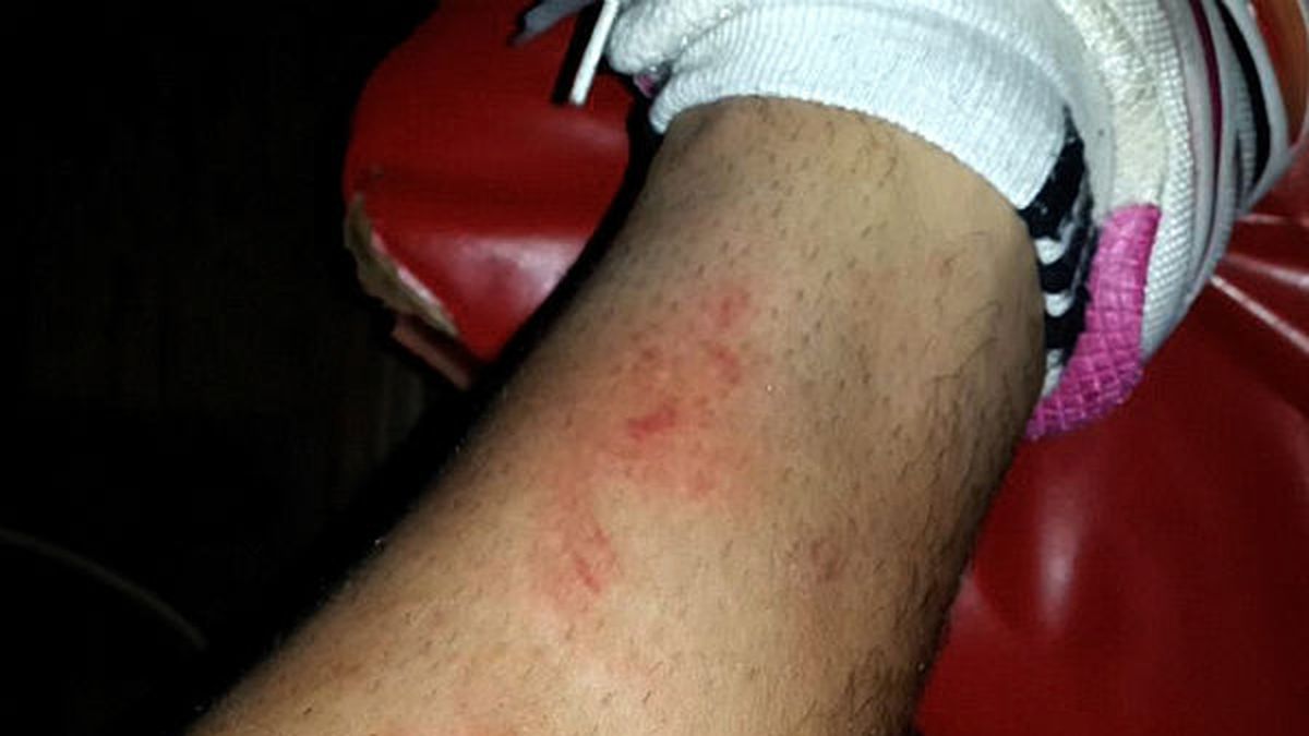 Gómez muestra foto de su pierna lastimada en el penal no cobrado