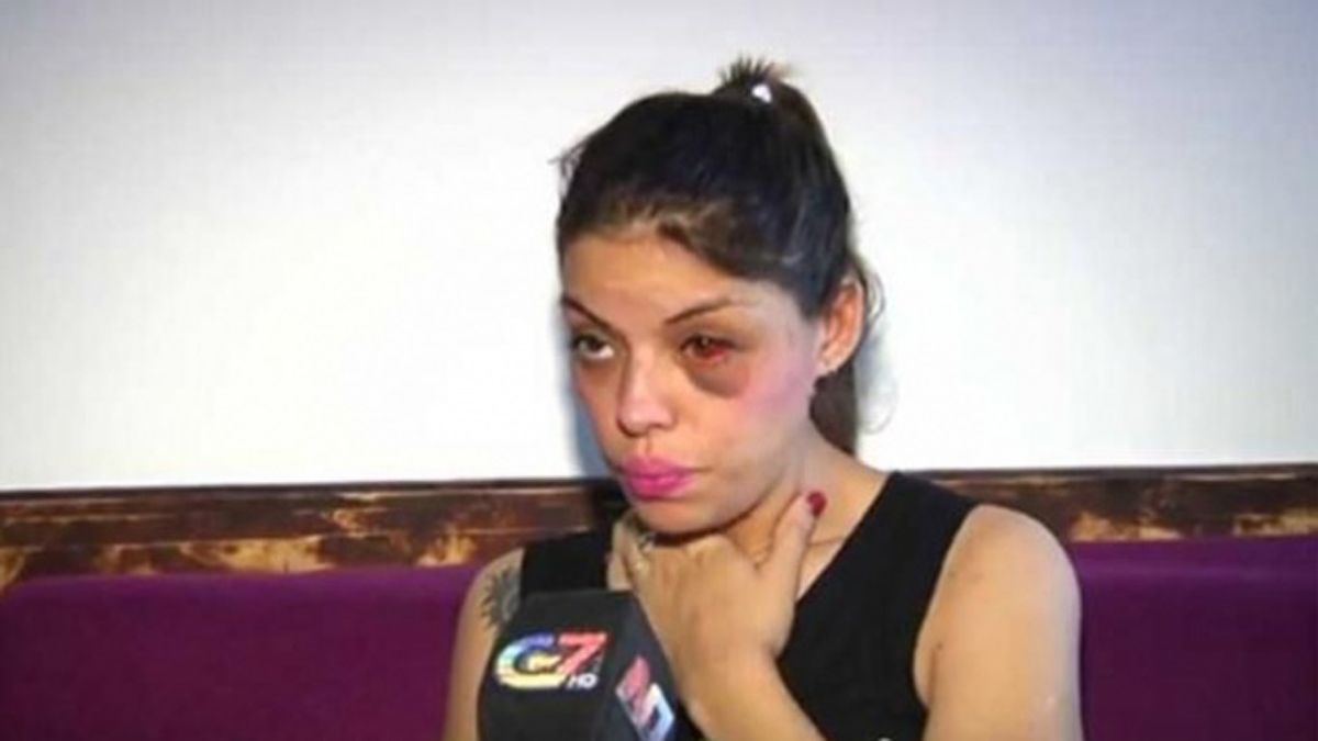 Su Ex Pareja La Desfiguró Y Se Salvó Al Tirarse Del Auto
