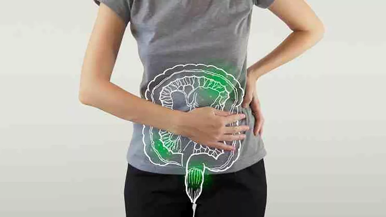 ¿Qué es la diverticulitis aguda?