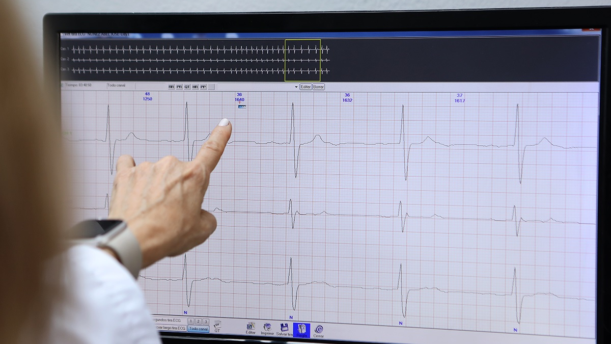 Avance argentino para mejorar los marcapasos