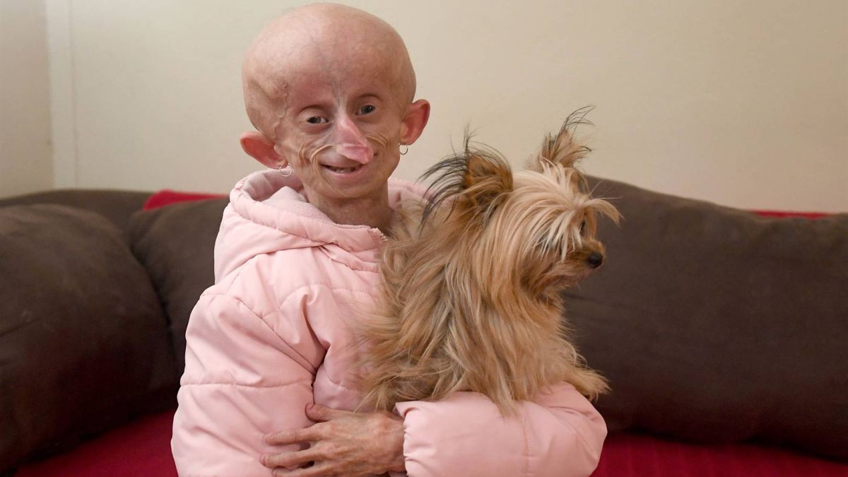 Murió Beandri Booysen, la tiktoker que inspiró al mundo