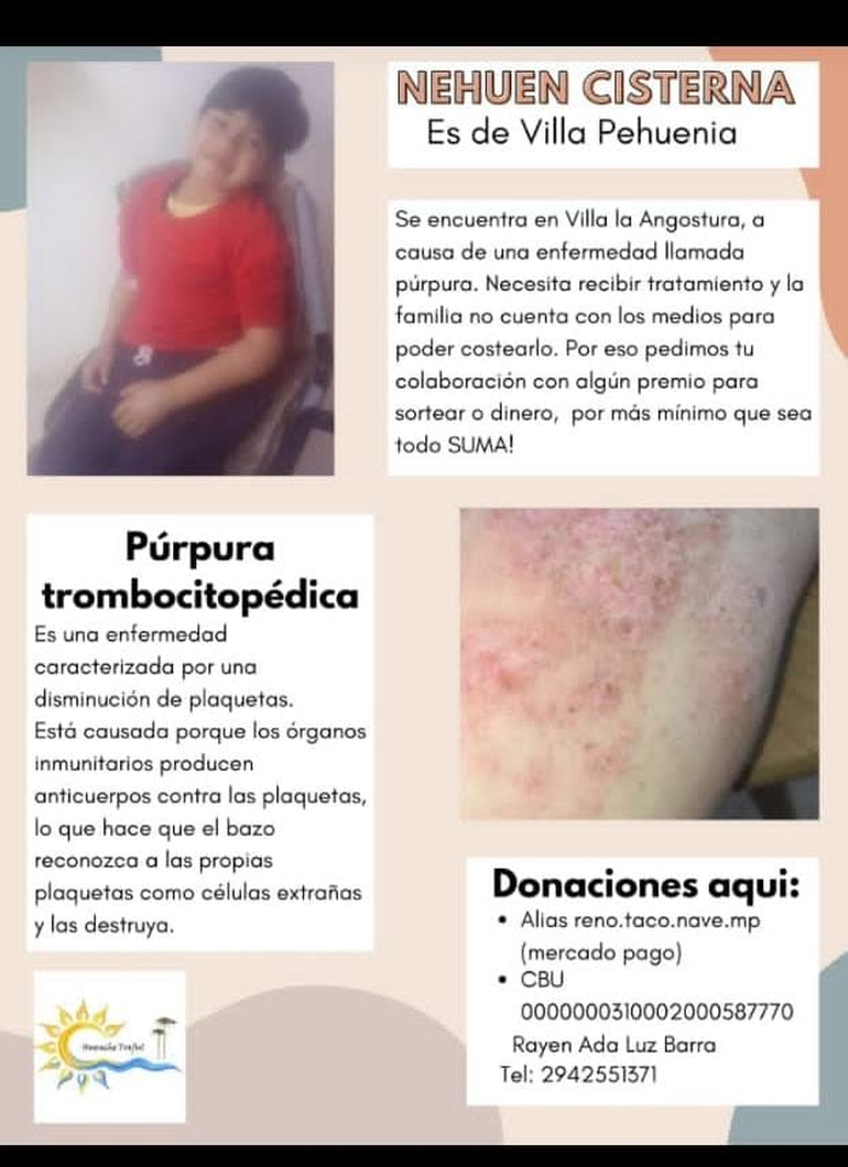 Colecta solidaria para un nene que padece una rara enfermedad en la sangre