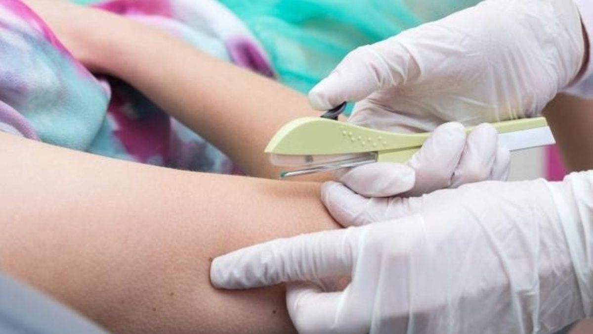 El implante subdérmico se impone como método anticonceptivo en Neuquén