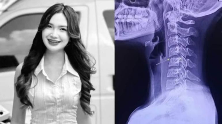 Reconocida cantante muere tras recibir una sesión de masajes