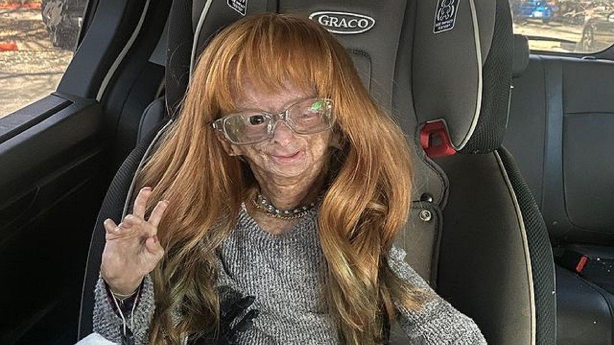 Murió la chica que inspiró la película de Benjamin Button