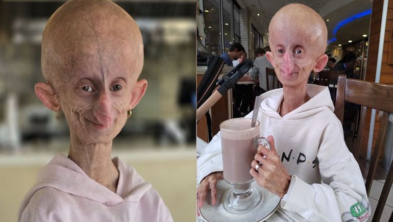 Murió Beandri Booysen, la tiktoker que inspiró al mundo