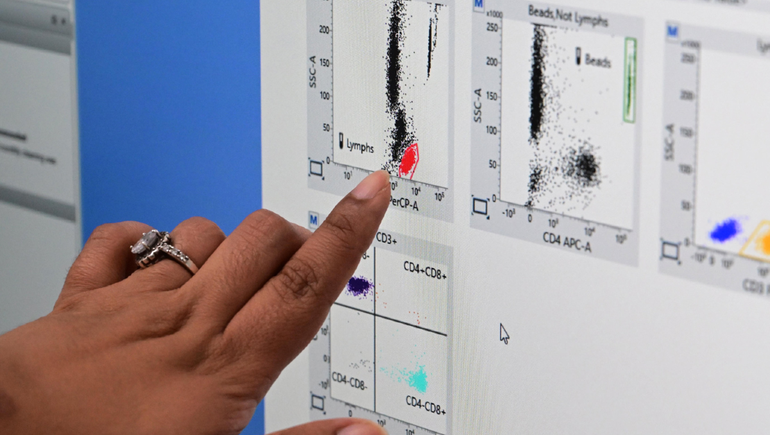 Citometría, estudio clave para detectar la leucemia
