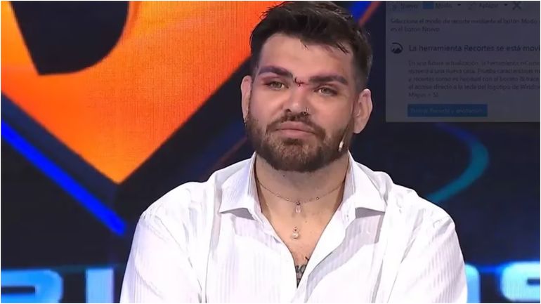 Fotos: el antes y después de Fran Mariano al operarse con Lotocki