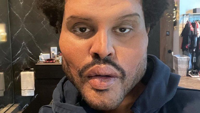 The Weeknd: su cara llena de botox viralizan su nuevo video